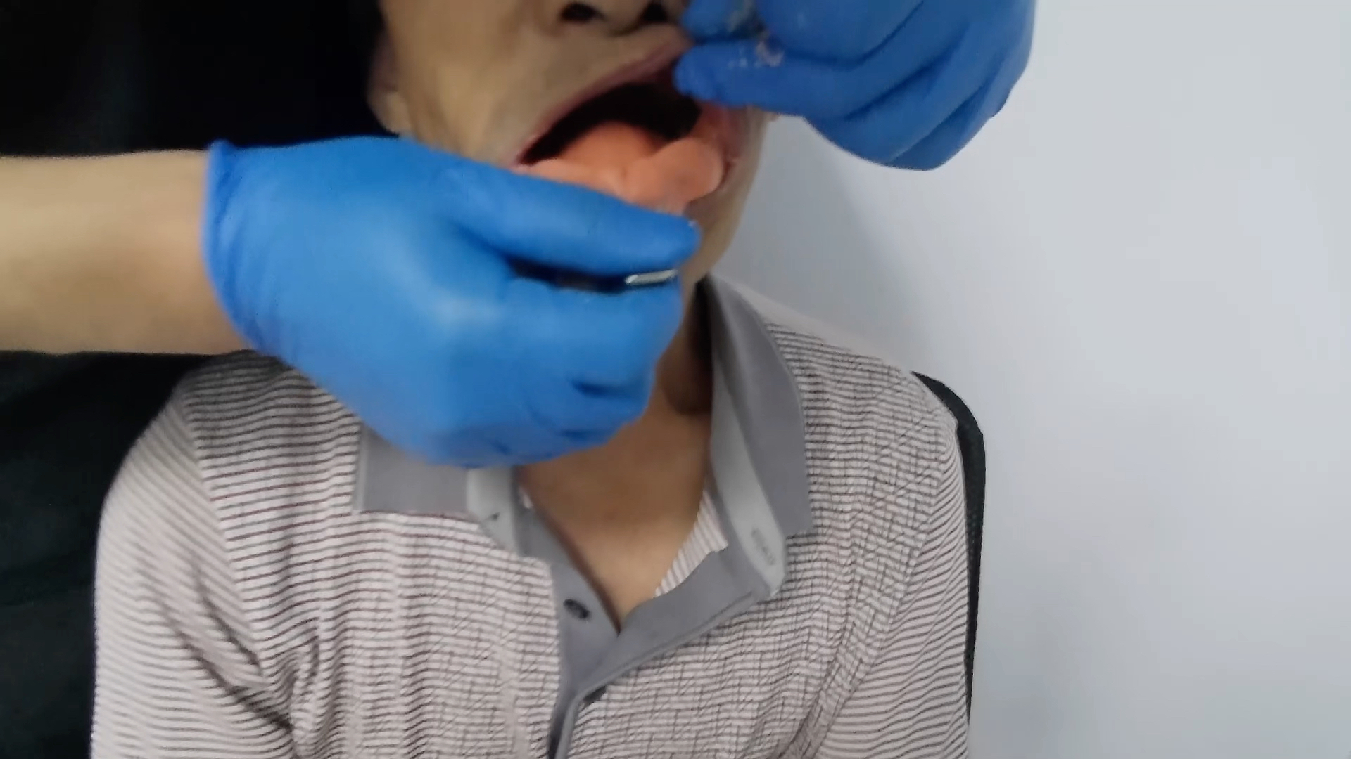 全口实操课之如何取好初印模