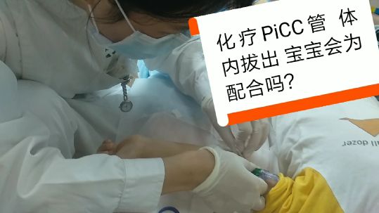 白血病 四岁男孩化疗结束 今天拔管piCC 妈妈 终于可以回家了