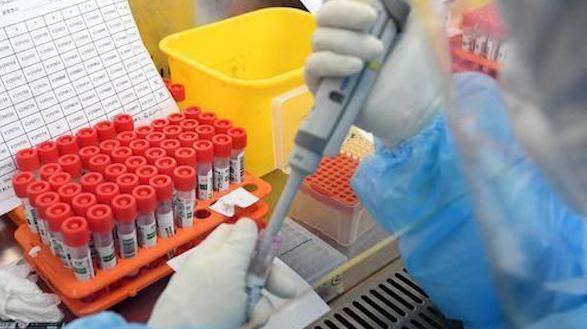 重磅!多国在2019年废水中发现新冠病毒,疫情时间或大幅提前