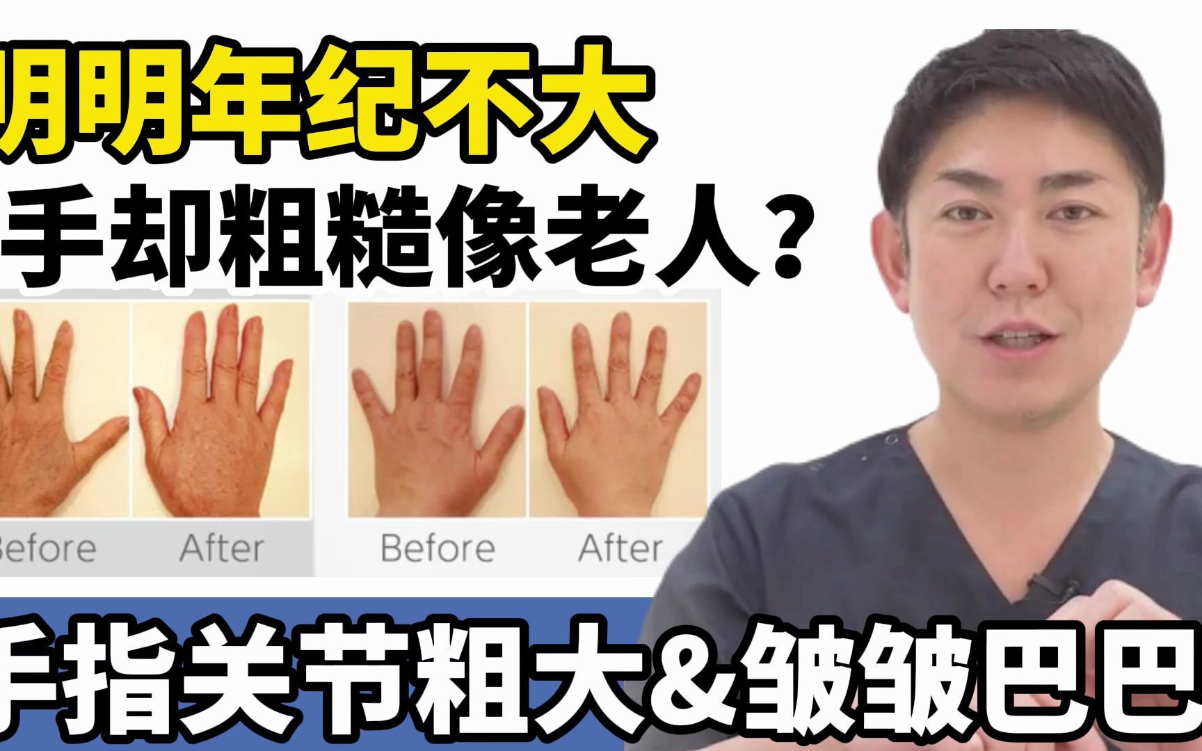 手部护理的重要性,你需要了解!教你保养手部肌肤