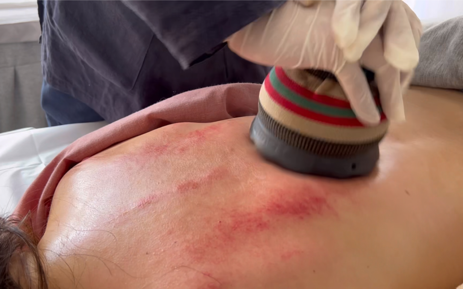 火龙罐舒筋通络,蓄养阳气,热量从后背往全身扩散