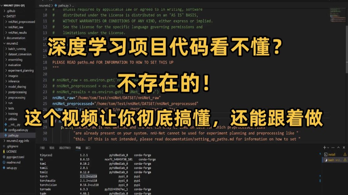 还在为看不懂深度学习项目代码而焦虑?一个视频结合项目深度拆解,让...