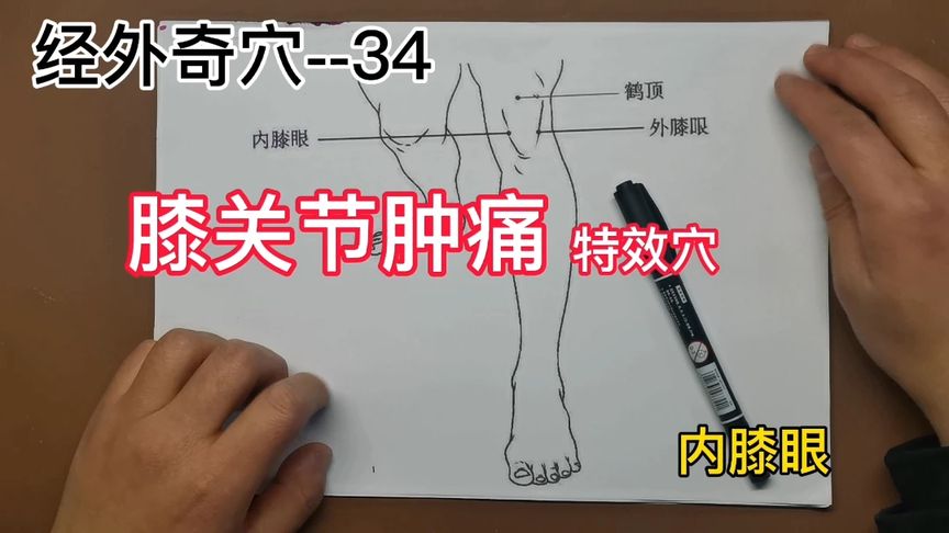 经外奇穴--膝关节疼痛可以试试内膝眼。