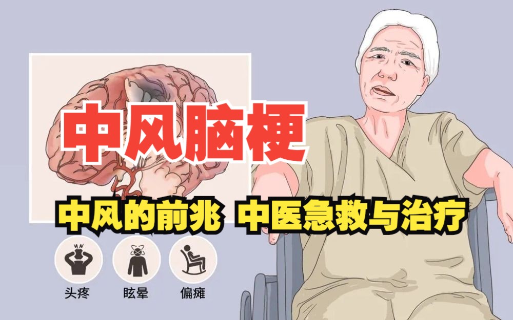 中风的征兆和中医急救方法,希望你一辈子都用不到,但一定要懂