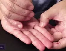 董氏针灸 王全民 11部 中间穴
