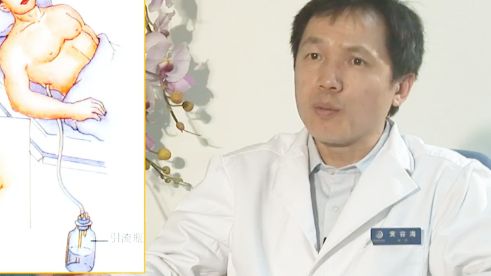 胆结石手术为什么要留置T管?有什么作用?
