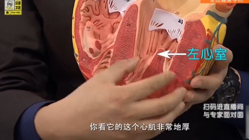 动脉粥样硬化斑块,堵塞血管,会导致心肌坏死!