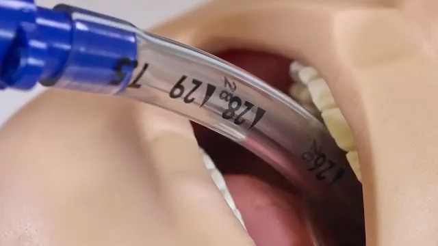 密闭式吸痰,气管插管,吸痰,护理,ICU,监护室技能,