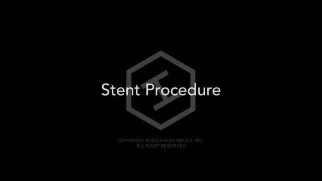 心脏支架释放过程