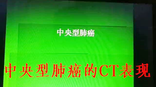 放射科医生教你读片:中央型肺癌的CT表现
