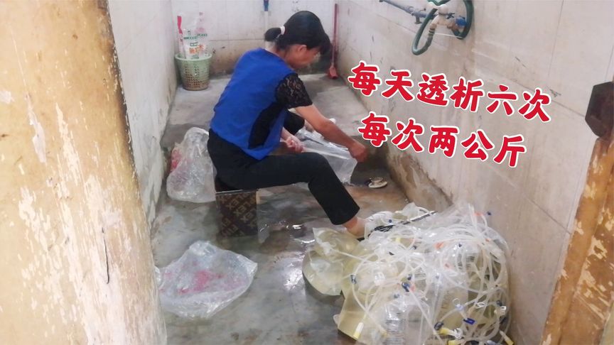 80后尿毒症女人,一天透析6次每天十多公斤重,往后就靠这些袋子