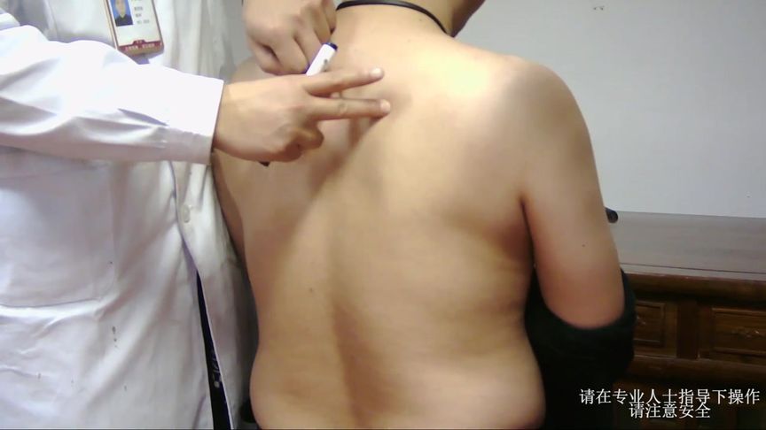 每日一穴位——肺俞穴(潮热、盗汗,按此穴)