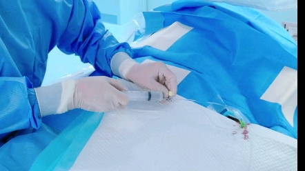 经桡动脉肝癌介入治疗