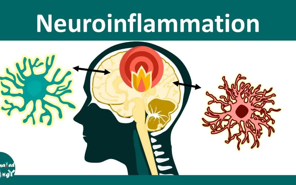 【中英文字幕】神经炎症 小胶质细胞在神经炎症中的作用