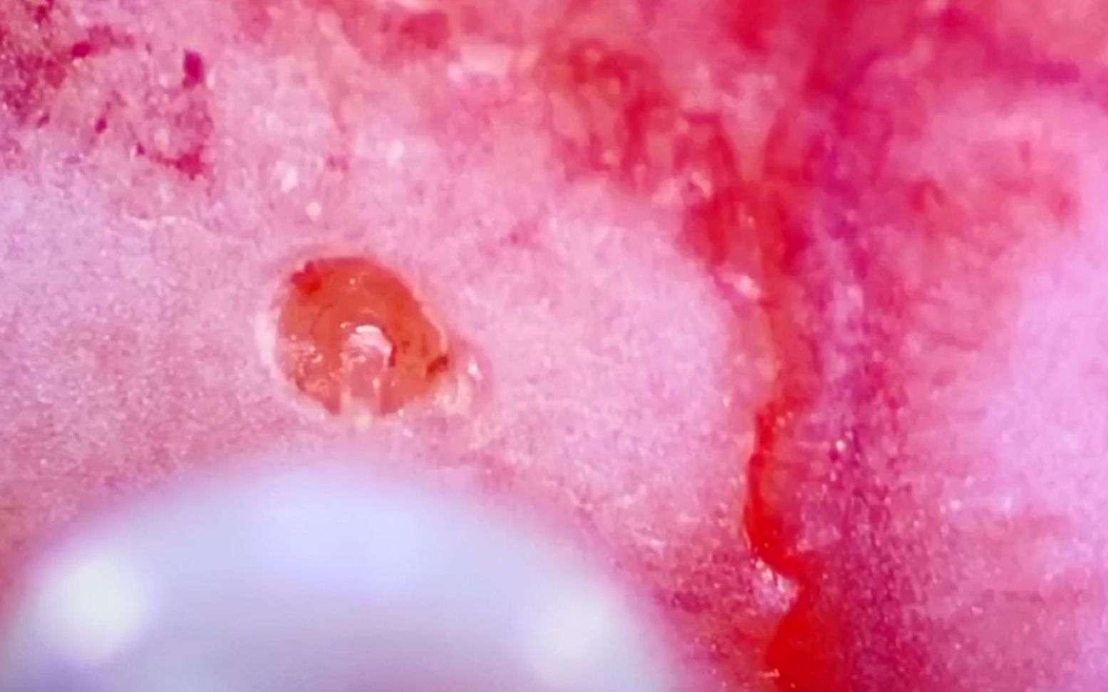 辅助光纤插芯精准植入,一步到位是种什么体验?