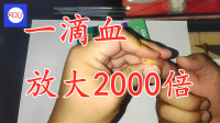 显微镜:血细胞放大2000倍,探索一滴血的微观世界