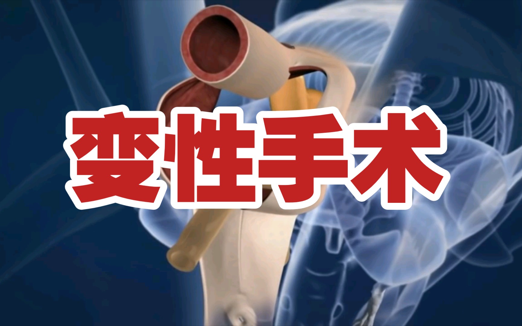 【医学喵】男孩子怎么变成女孩子?|变性手术怎么做?
