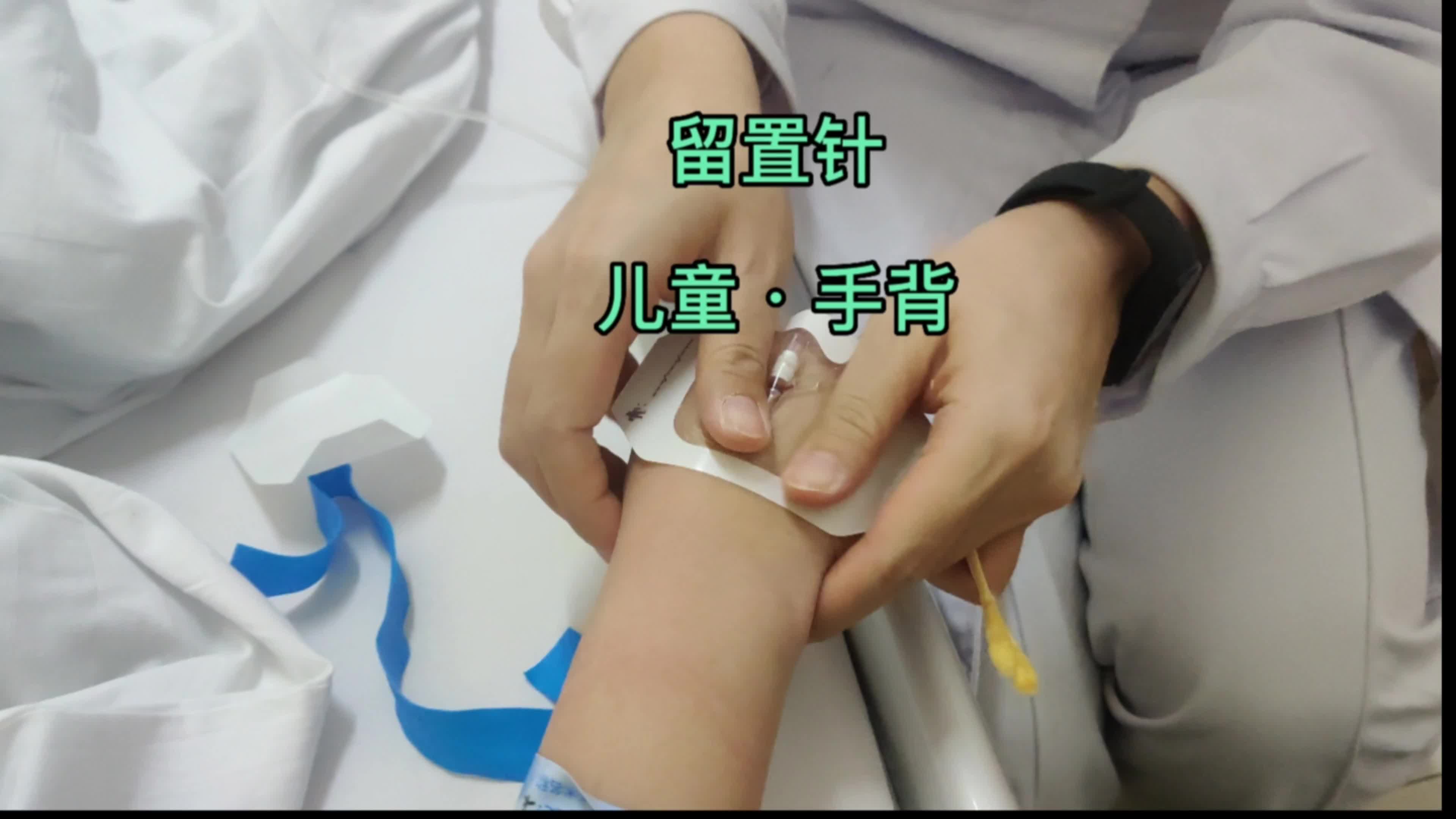 那些扎不上的留置针,满病区都是我的名字!