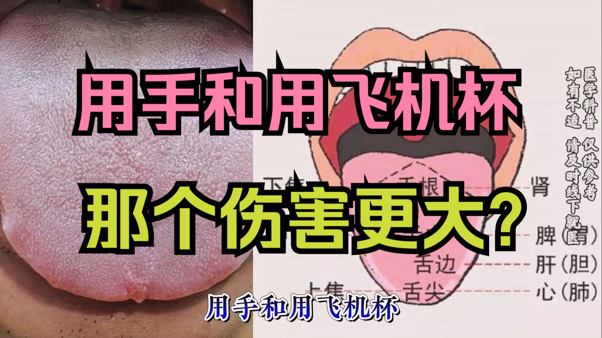 用手和用飞机杯哪个伤害更大呢?中医让你重振男人雄风!