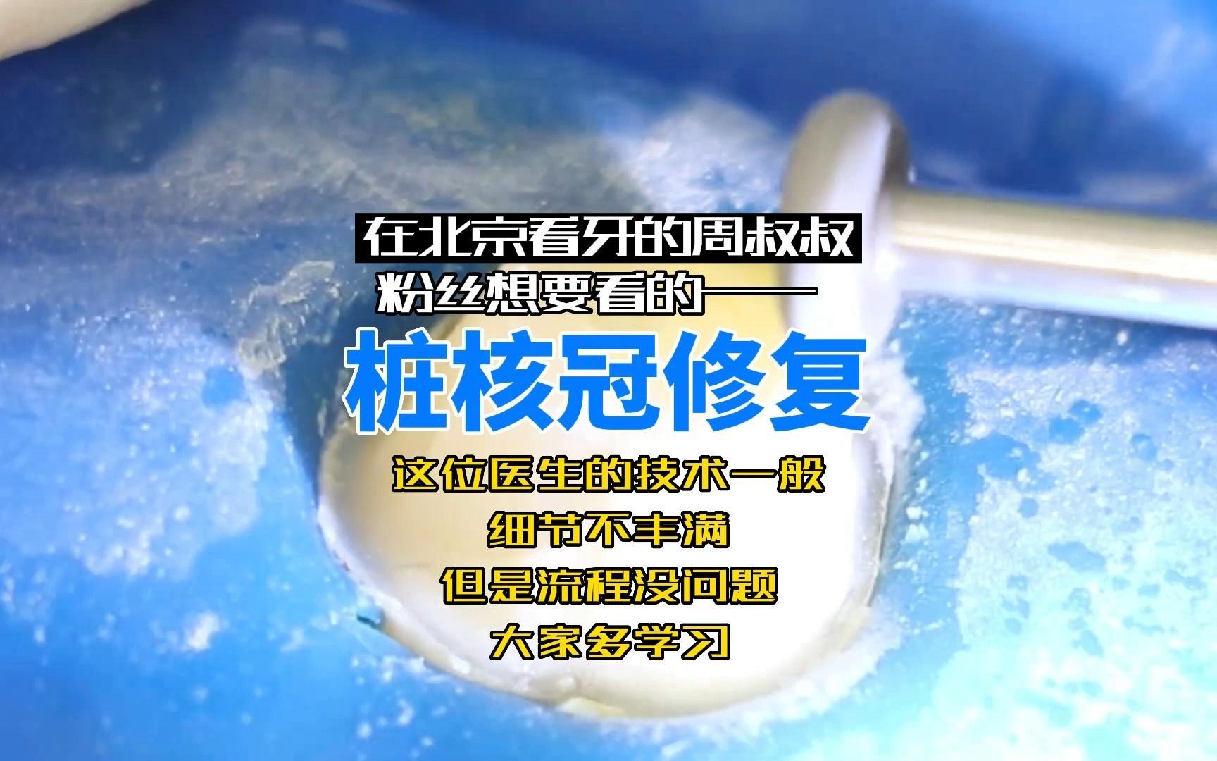 桩核冠修复流程