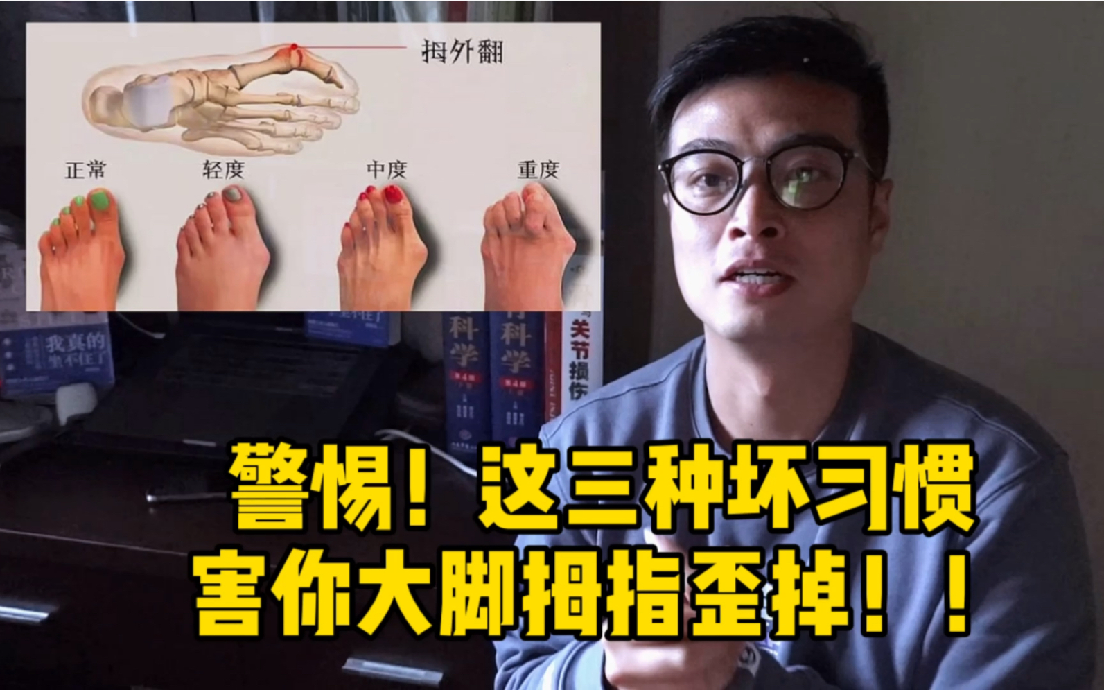 警惕!这三种坏习惯害你大脚拇指歪掉!