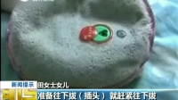 电热水袋突然爆炸 胳膊被烫伤 新闻早报 161109