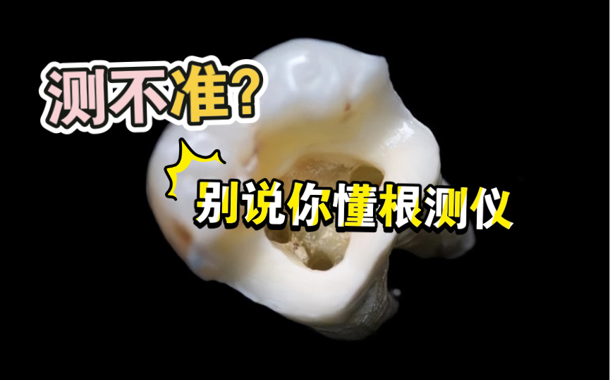 “我的根测仪为什么测不准”