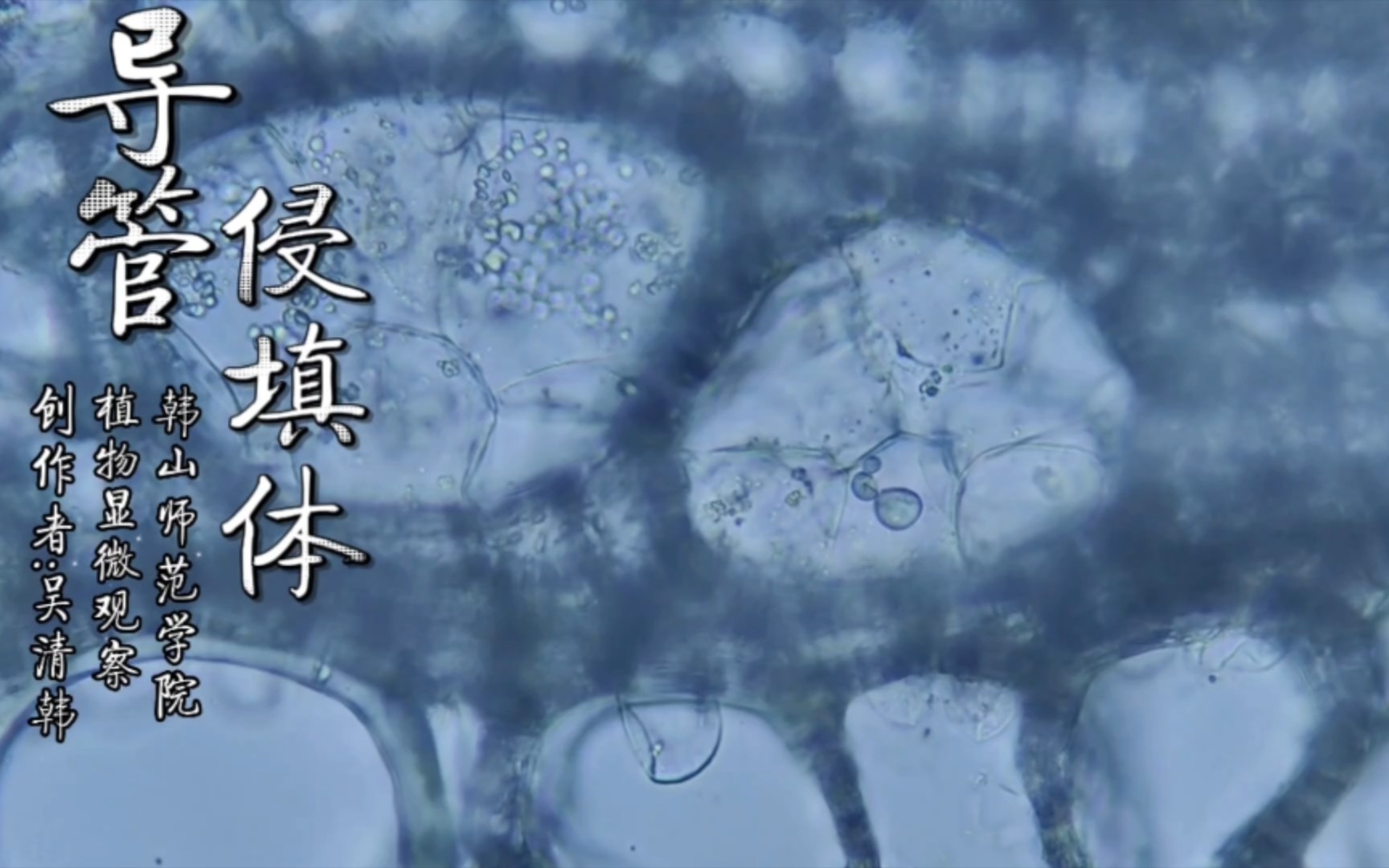 侵填体:木质部导管或管胞失去输导功能的原因之一