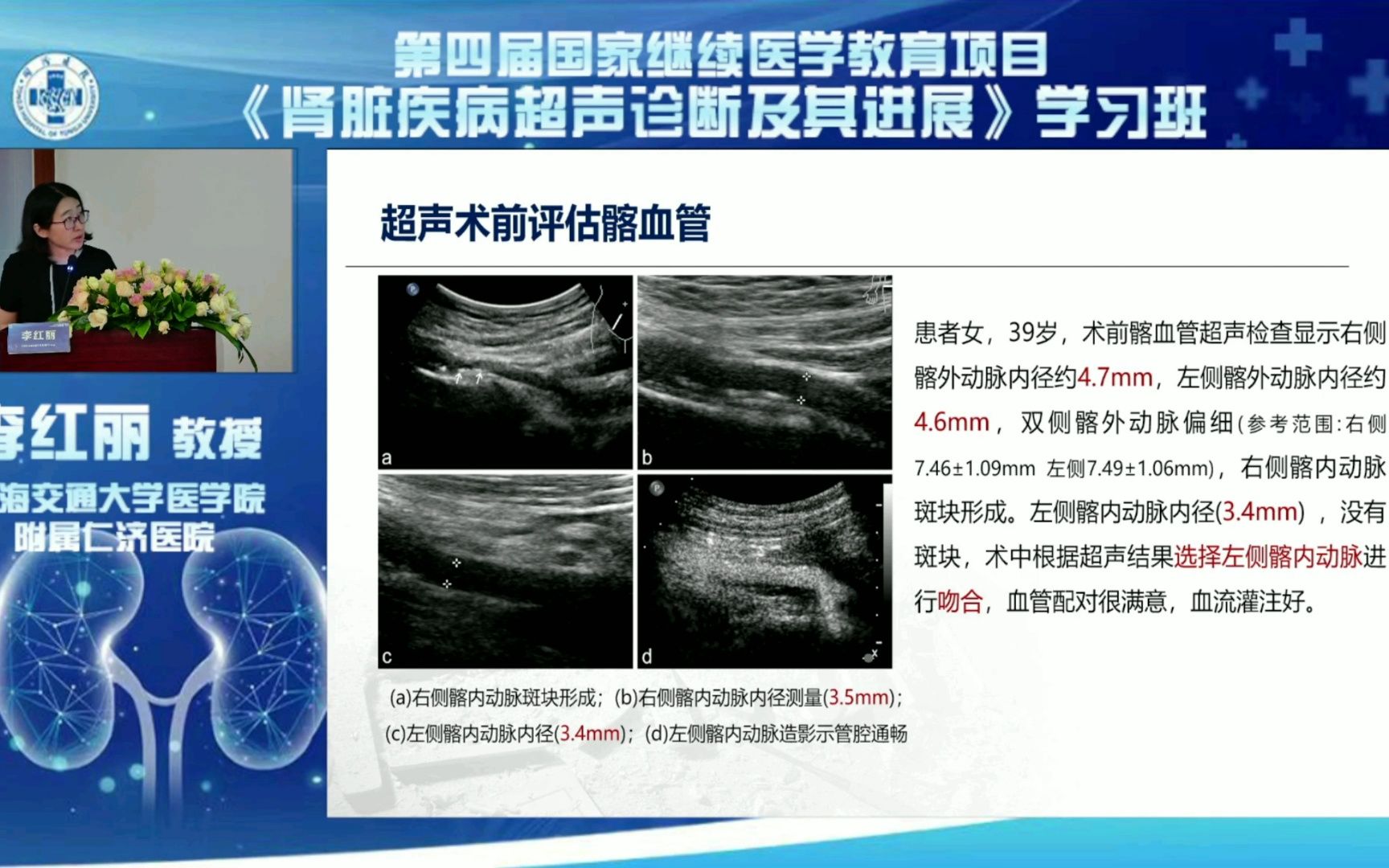 肾移植超声评估--李红丽(上海交通大学医学院附属仁济医院)