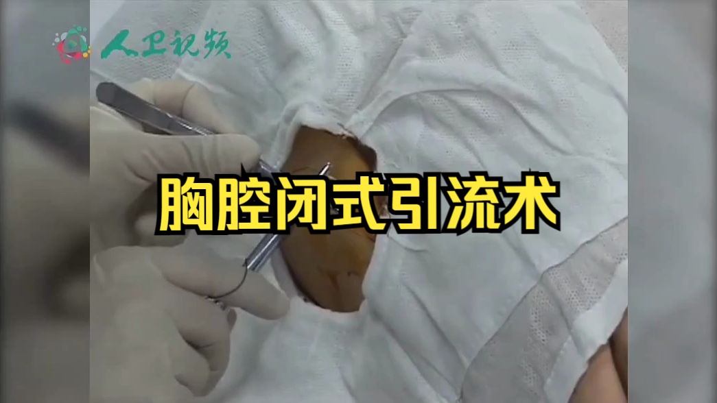 胸腔闭式引流术