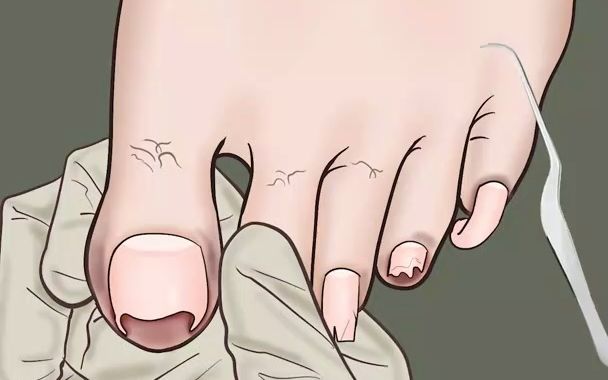【沉浸式修脚】 脚趾甲护理动画