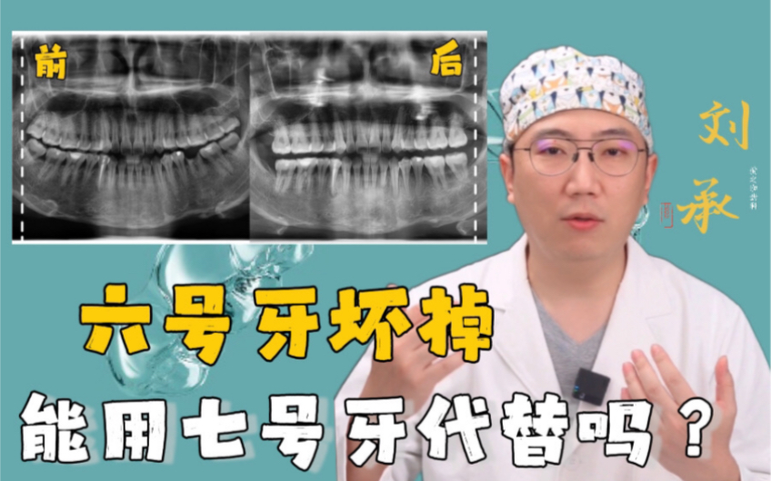 六龄齿六号牙坏掉能用七号牙代替吗?