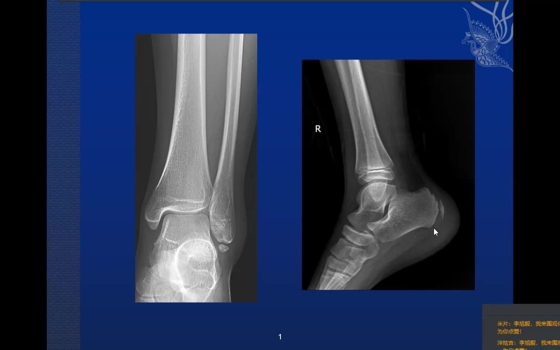 温州医科大学附属第二医院放射科陈伟—住院医师规范化培训课程《...