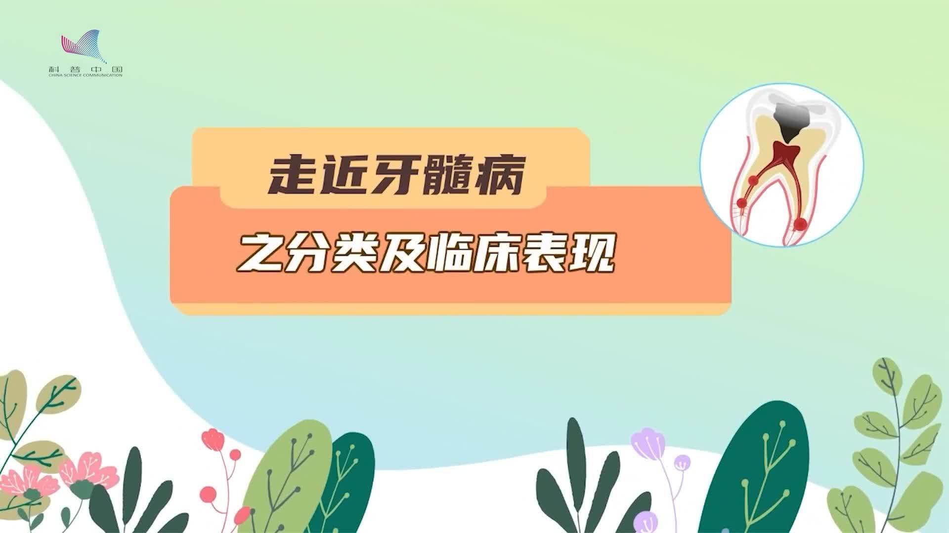 走近牙髓病之分类及临床表现?