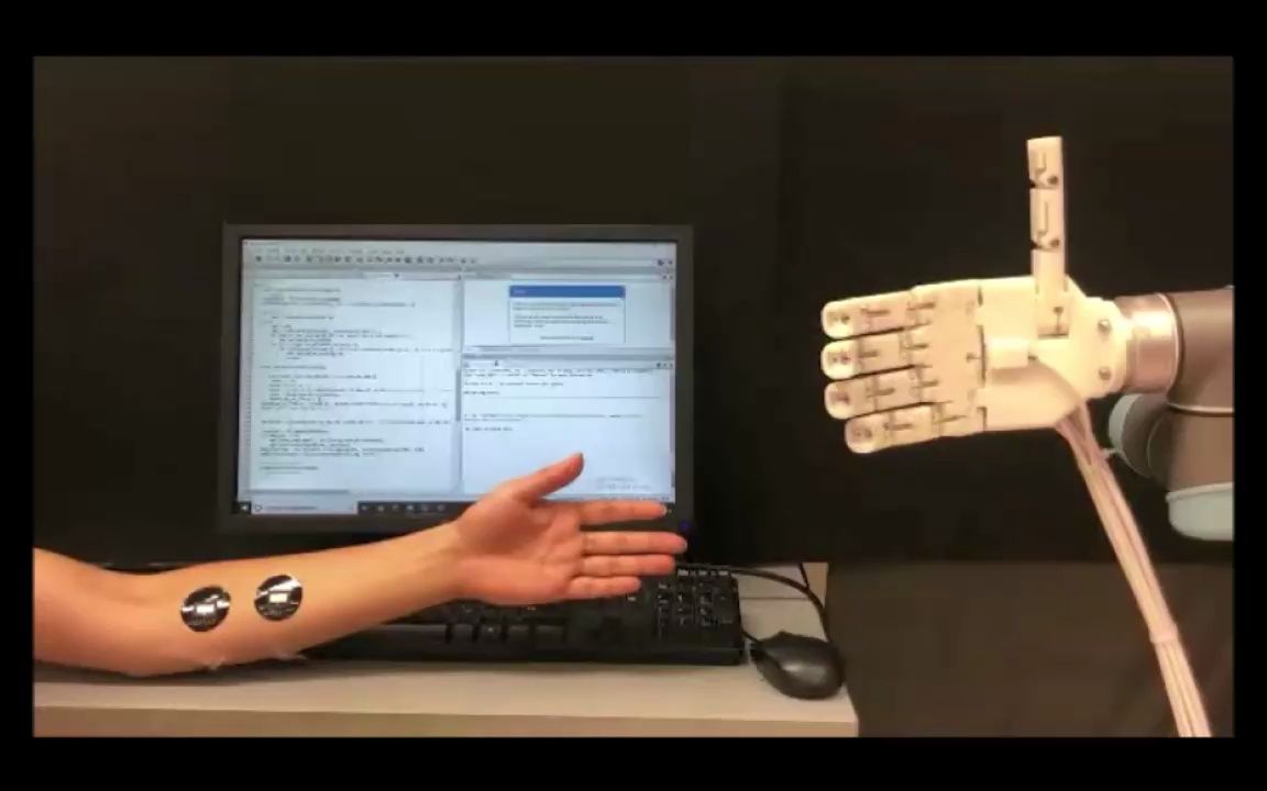 可拉伸自粘附纯有机干电极用于长期稳定检测人体表皮生物电信号