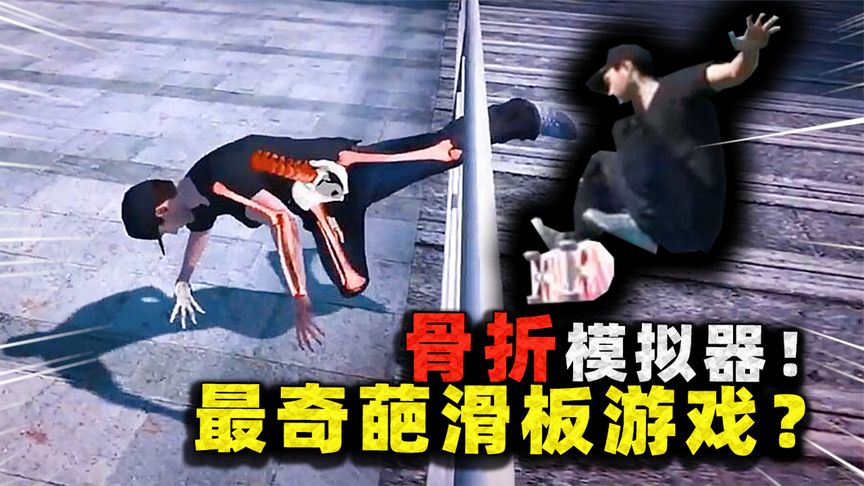 骨折模拟器:最奇葩滑板游戏!张叔这身老骨头,竟摔得比铁还硬?