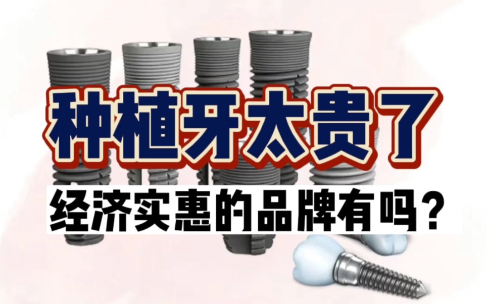 种植牙太贵了,经济实惠的品牌有吗?