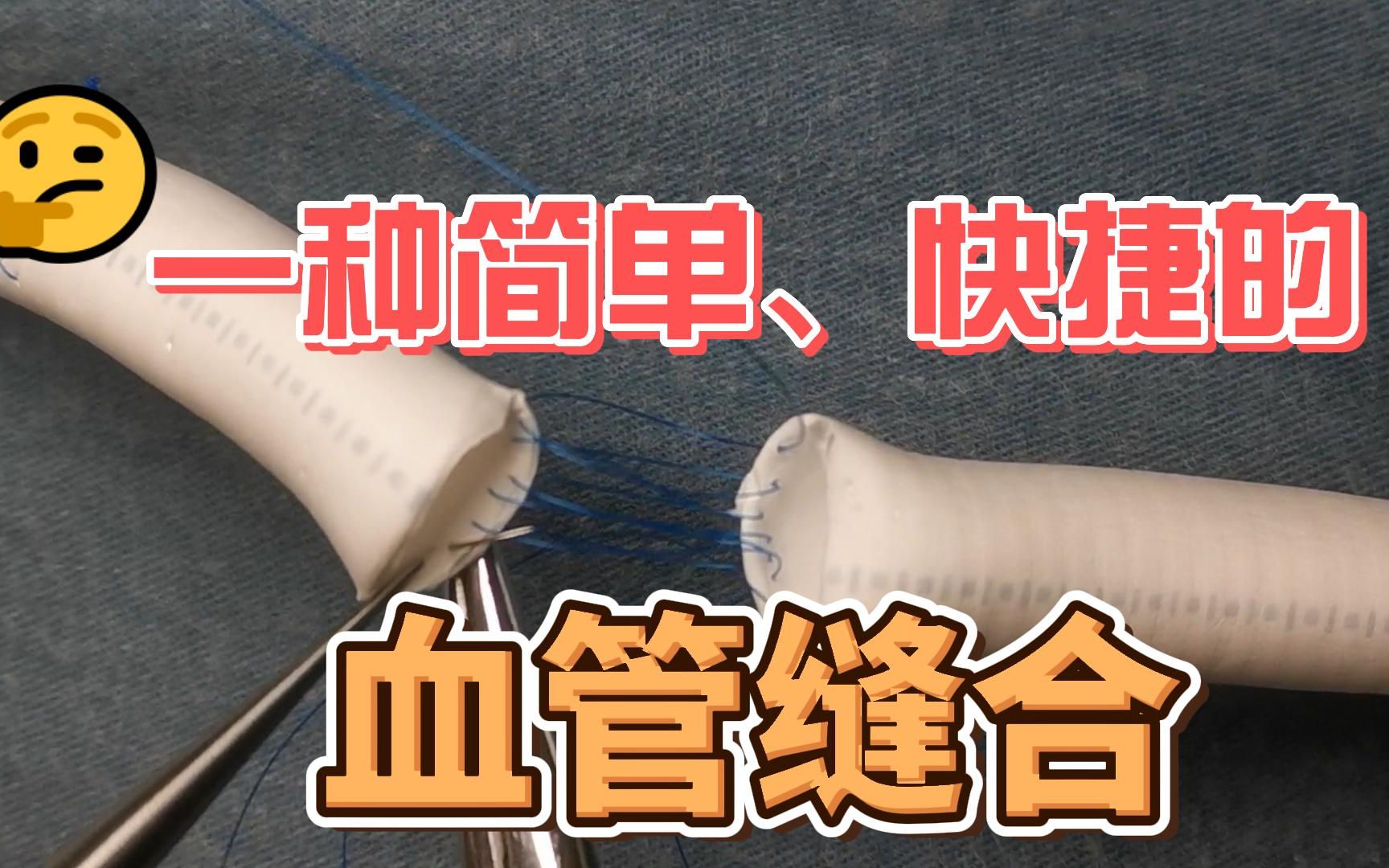 一种简单、快捷的血管缝合方法