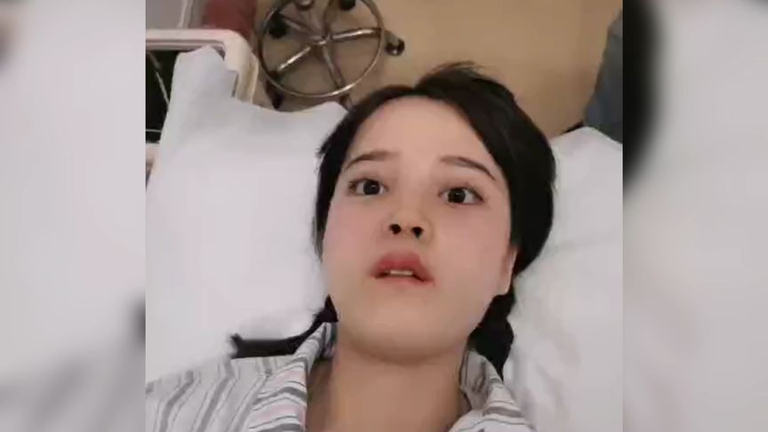 正颌手术后拔引流管