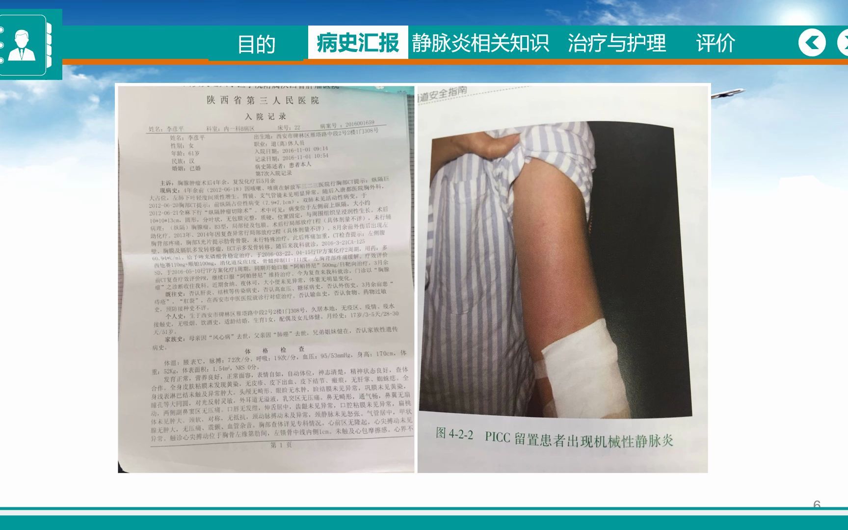 静脉炎患者个案护理PPT