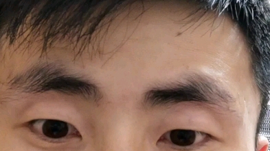 每次微信人脸识别不出,尴尬的一直眨眼睛