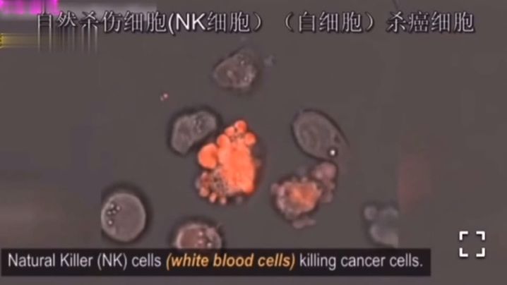 显微镜下看身体细胞如何杀死病毒,细菌,癌细胞