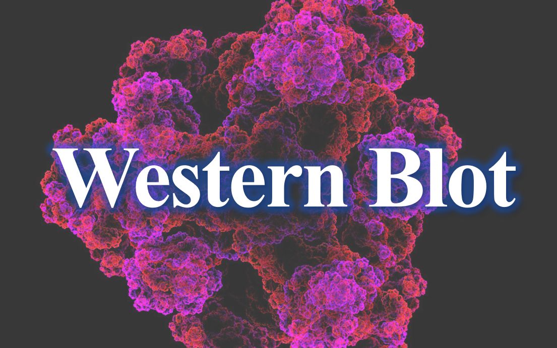 【WB】蛋白质Western Blot实验原理,大家来检查一下学姐讲的对不对