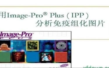 Image pro plus 批量分析免疫组化