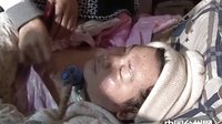 付学朋下山住进台一医 成功进行呼吸导管手术