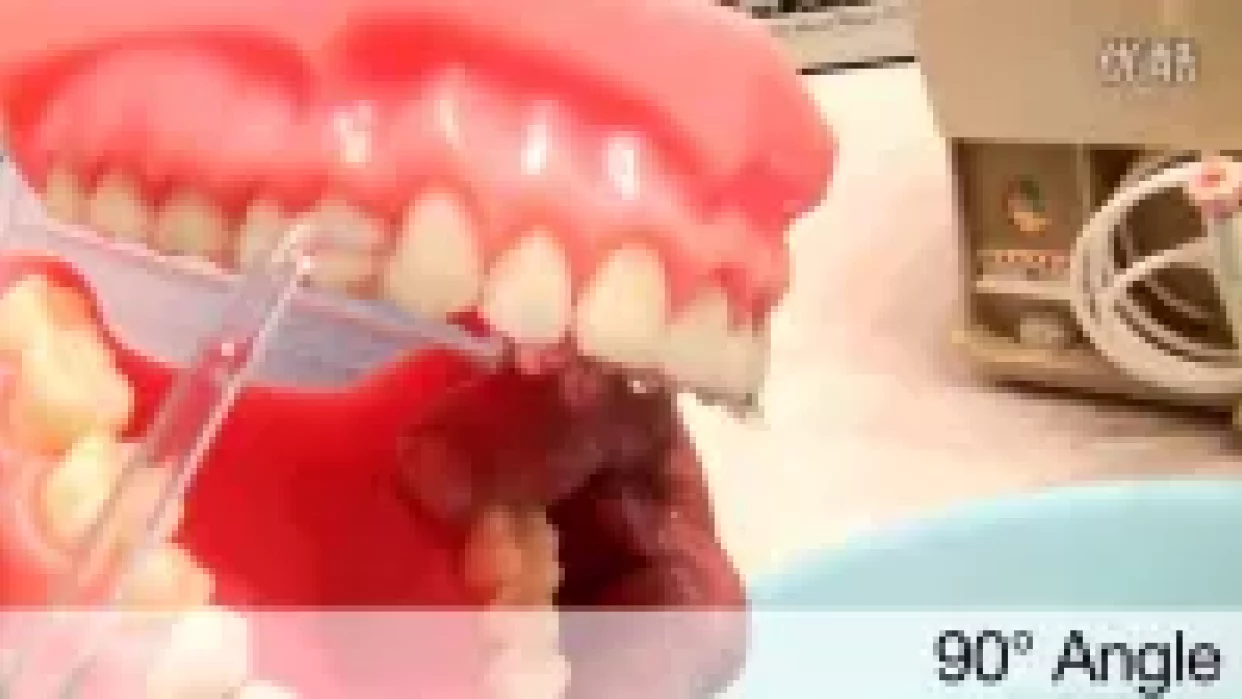 教你如何使用冲牙器