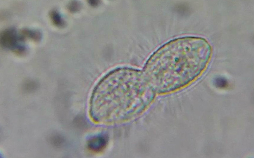 几种水生微生物,草履虫