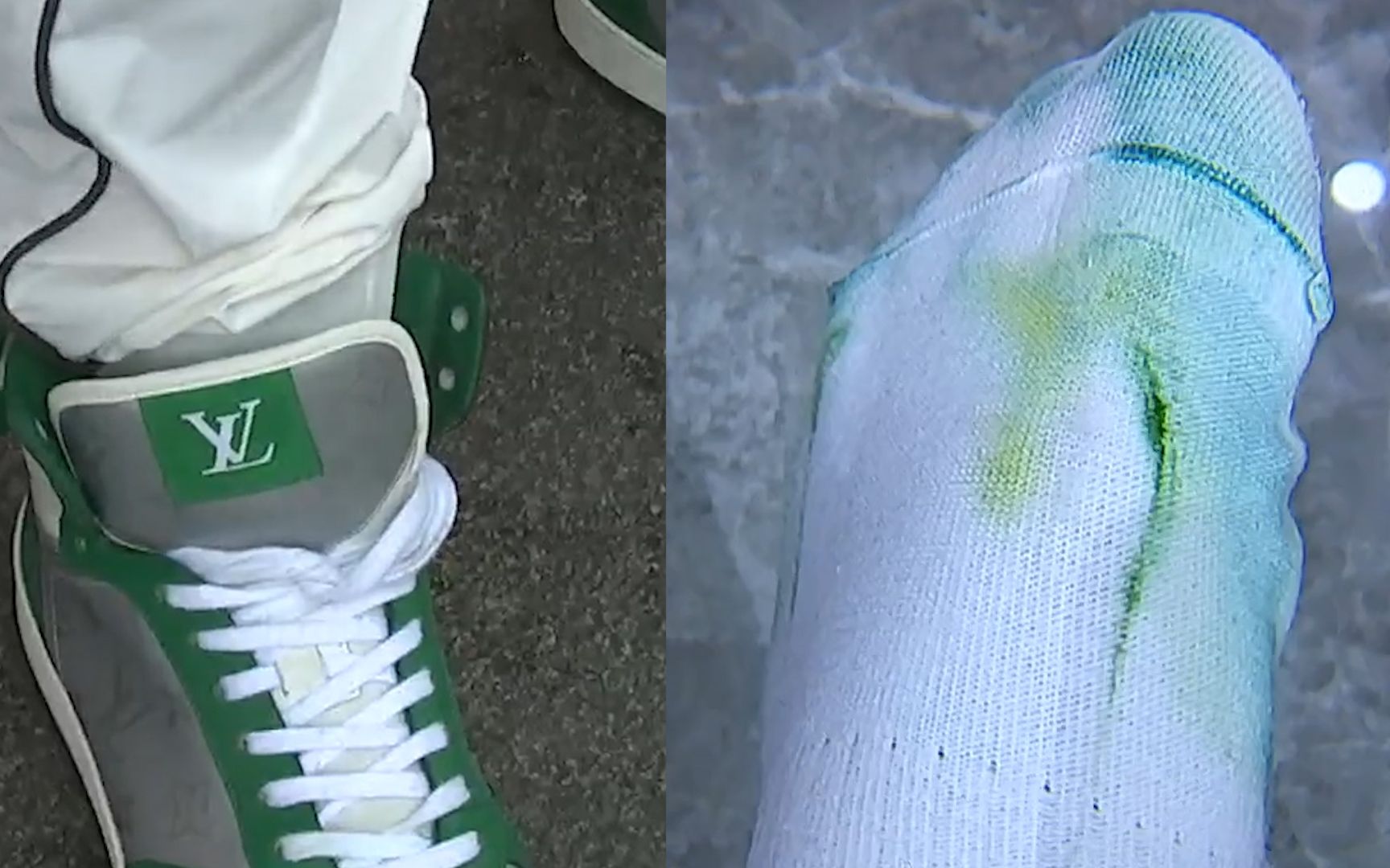 男子八千多买LV鞋一天就掉色,袜子脚指甲盖都被染绿:货真价实?