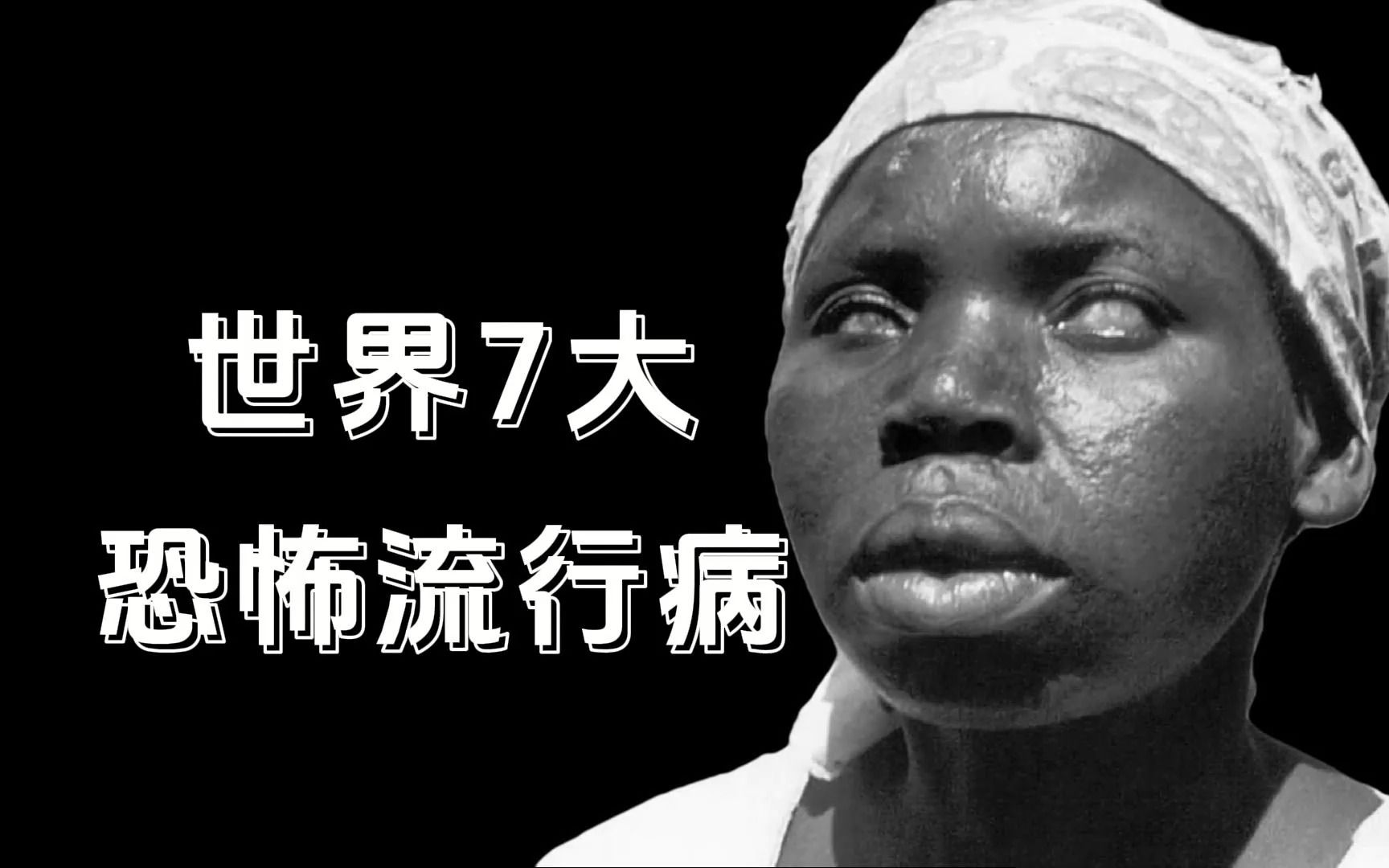 杀死数十亿人!历史上最恐怖的7大传染病