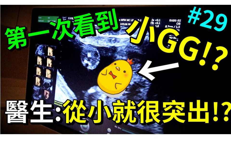 【默森孕妇日记#29】第一次看到儿子小GG!?医生表示小孩从小就很...